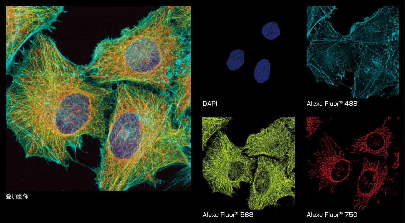 Nikon发布超高分辨率多光子共聚焦显微镜“AX R MP with NSPARC” | 尼康精机（上海）有限公司